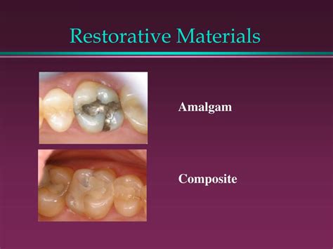 Ppt Class I And Ii Composite Restorations Principles And Techniques Powerpoint Presentation Id