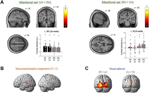 Significant Brain Activation Differences A Main Effects Of
