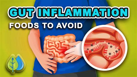 Top 5 Foods That Cause Gut Inflammation Avoid