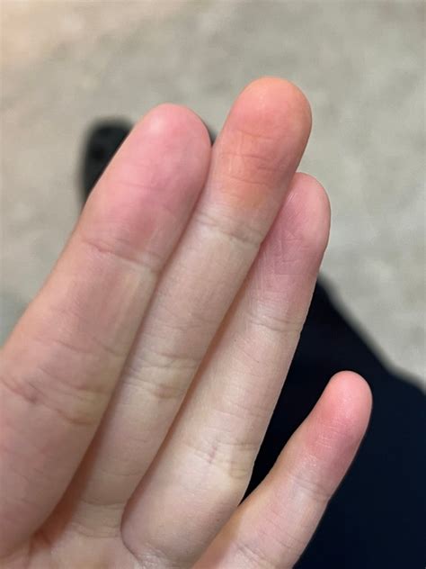 손가락 끝 주황색 지식in