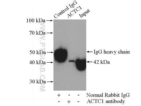 Alpha Cardiac Muscle Actin Antibody 11032 1 Pbs Proteintech
