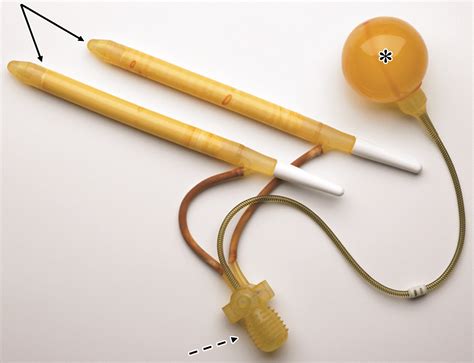 Ct And Mr Imaging Features Of Artificial Urinary Sphincters Penile