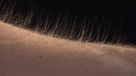 Arm Hair Growing In Different Directions At John Mcclure Blog