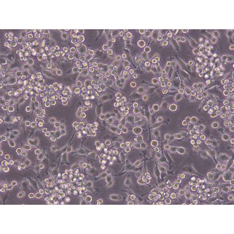 Bv2 小鼠小胶质细胞 索莱宝 主营生物科研试剂and抗体 蛋白 多肽 试剂盒 专业定制化服务平台 Solarbio【网上商城