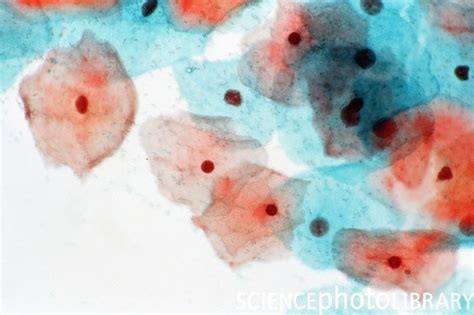 Homage To The Seed Weblog Under The Microscope