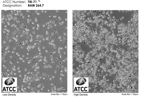巨噬细胞应该如何培养呢？