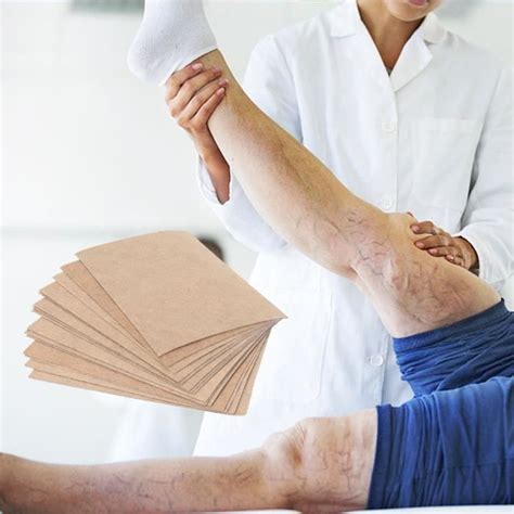 Surenhap Patch De Soulagement Des Varices Ensemble De Patchs De