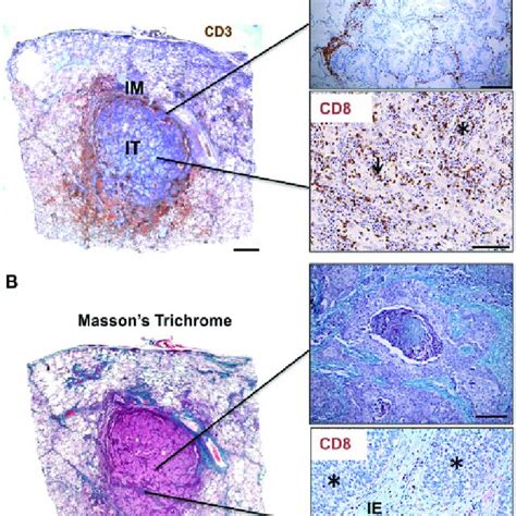 Assessment Of The Spatial Architecture Of Tumour Infiltrating