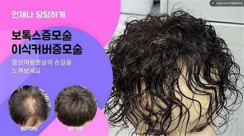 증모가발전문점 더채움 증모여왕햇살 은 탈모인들을 위해 모발을 설계하는 모발설계사 입니다 Facebook