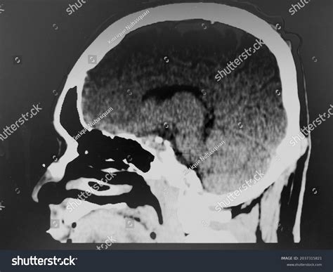 Normal Ct Scan Over 358 Royalty Free Licensable Stock Photos Shutterstock