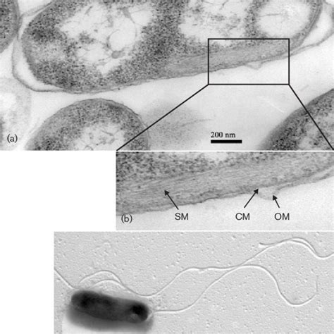 A Electron Micrograph Of A Thin Section Of Cells Of Strain Tb 2 T