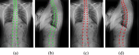 Figure 1 From Multi View Fusion Convolutional Neural Network For Automatic Landmark Location On