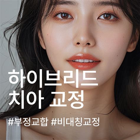 하이브리드 치아 교정 할인 가격 후기 전후 효과 정보 By 연세하랑치과의원 여신티켓 국내 1등 피부과 성형외과 플랫폼
