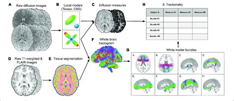 Mri Processing Pipeline A Inputs Diffusion Weighted Images Are Download Scientific Diagram