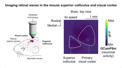 Imaging Retinal Waves In The Mouse Superior Colliculus And Visual Cortex Youtube