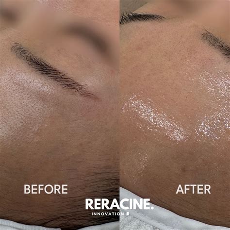 울산피부관리 리페어에스테틱 대표원장 한 유주 발라서 이렇게 된거 아니죠오~ 피부 진피부터 표피까지 튼튼하고 건강하게 피부가