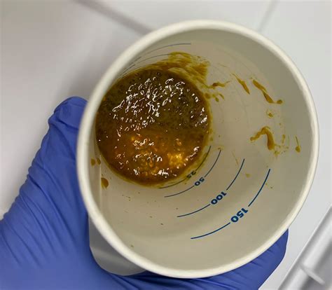 Stool Examination Microscopic And Macroscopic At Sharlene Burcham Blog