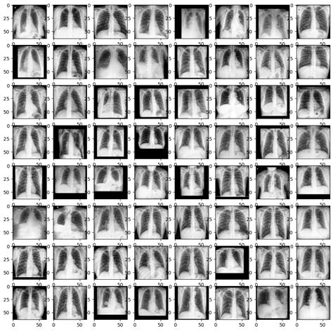 GitHub Kaledhoshme Predict Age Of Patient Based On The X Ray Images Create A Model Capable