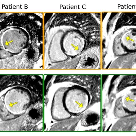 Examples To Illustrate High Visuospatial Agreement Between Virtual Download Scientific Diagram