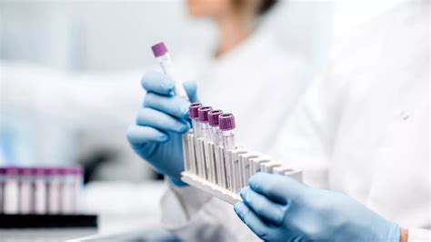 Endothelial Activation And Microcirculatory Disorders In Sepsis And
