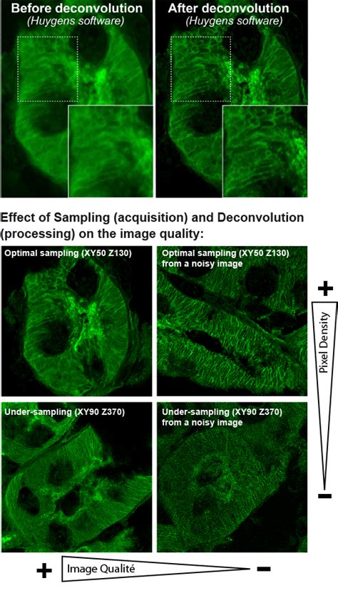 Deconvolution Bioimaging Unige