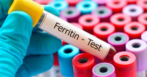 Ferritin Nedir Ferritin Eksiği Neden Olur