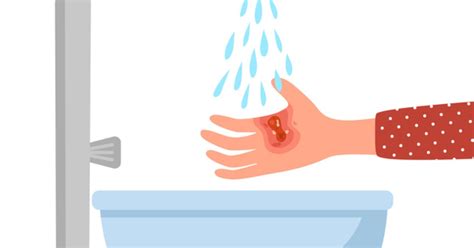 앗 뜨거 전 부치다 데인 손 무심코 얼음 댔다간 한 장으로 보는 건강