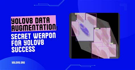 Yolov8 Data Augmentation Secret To Success Yolov8