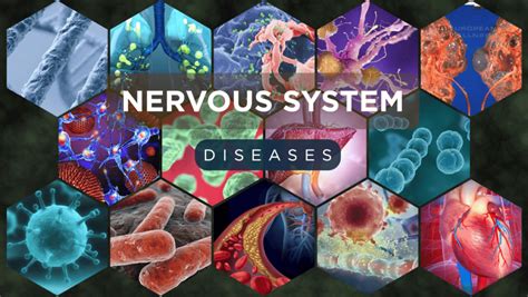Nervous System Diseases Explained Causes Symptoms And Treatments European Wellness