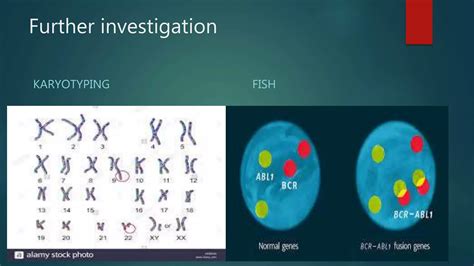 Myeloproliferative Disease Cml Pptx