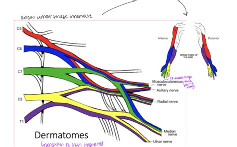 Module 29 Upper Extremity I Brachial Plexus Flashcards Quizlet
