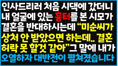 신청사연 인사드리러 처음 시댁에 갔더니 내 얼굴에 있는 흉터를 본 시모가 결혼을 반대 하시는데 미순씨가 상처 안 받았으면~ 사이다사연 감동사연 라디오 드라마