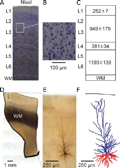 3d Reconstruction Of Single Cell Dendritic Morphology In Human Temporal