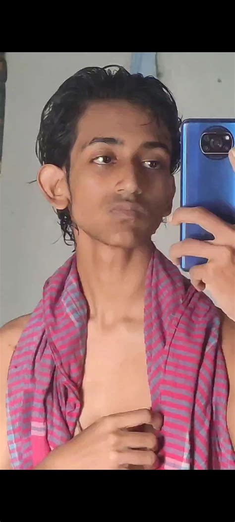 13 15 Mewing And Puberty R Mewing