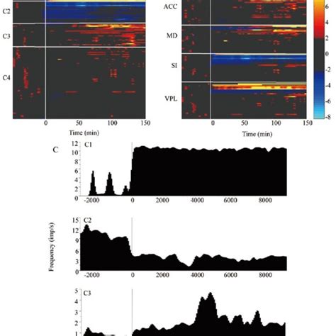 Temporal Distribution Pattern Of Spontaneous Neuronal Activity Before