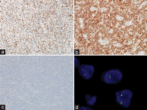 Surgical Neurology International