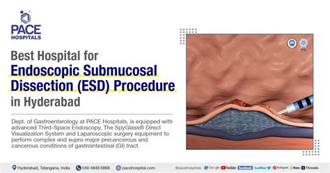 Endoscopic Submucosal Dissection In Hyderabad Indications And Cost