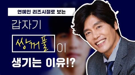 갑자기 생긴 쌍꺼풀 Youtube