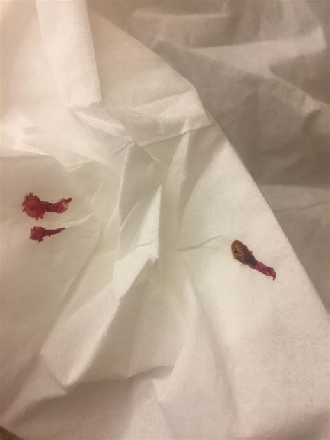 Bed Bug R Whatsthisbug