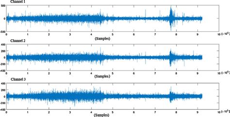 Interictal Preictal Ictal And Postictal States Of Seizures From Three Download Scientific
