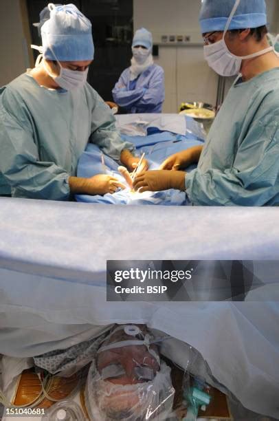 Phalloplasty Step 1 Photos And Premium High Res Pictures Getty Images