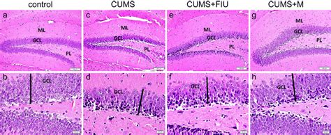 The Dentate Gyrus Of The Hippocampus Of The Control A B Cums C