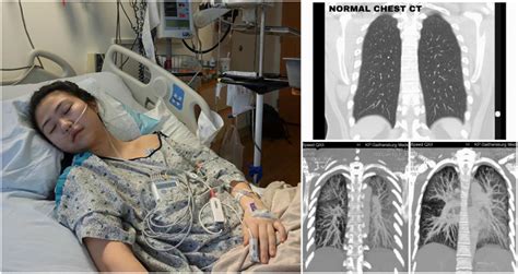 Teen Shares Heartbreaking Instagram Post About The Dark Realities Of Vaping