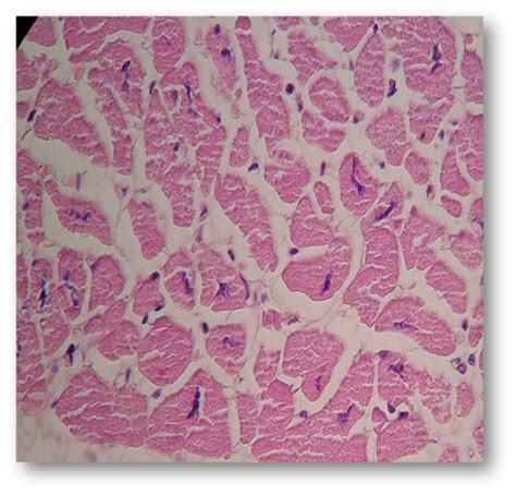 M Flashcards Quizlet