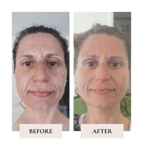 Mouth And Cheek Jumpstart Face Yoga Method