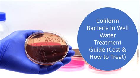 Water Filtration System To Remove Coliform Bacteria At Sharon Soliz Blog