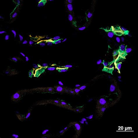 Intercalated Cells Object Detection Model By Etienne Chollet