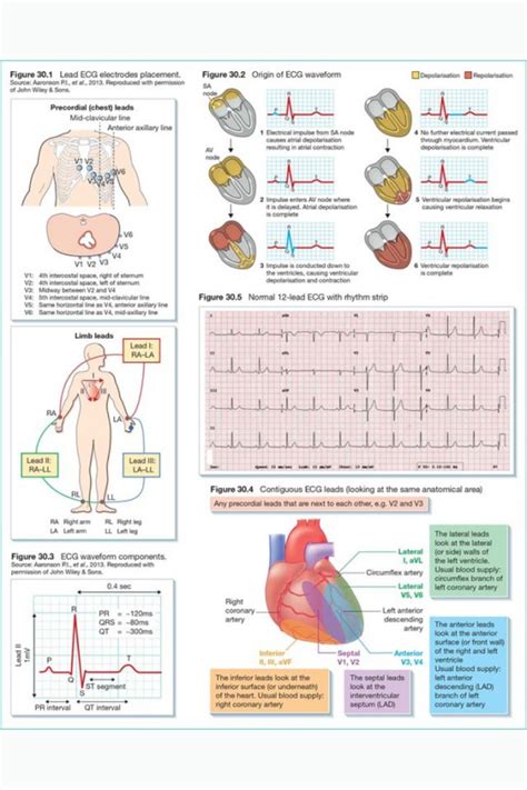 Ecg Basics Ekg Interpretation Artofit