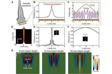Acoustic Elasticity Imaging Using Adaptive Profile Technology Resistant To Diffraction Qs Papers