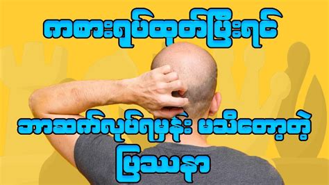 ကစားရုပ်ထုတ်ပြီးသွားရင်သိထားရမယ့် အခြေခံပွန်းအနေအထား Youtube